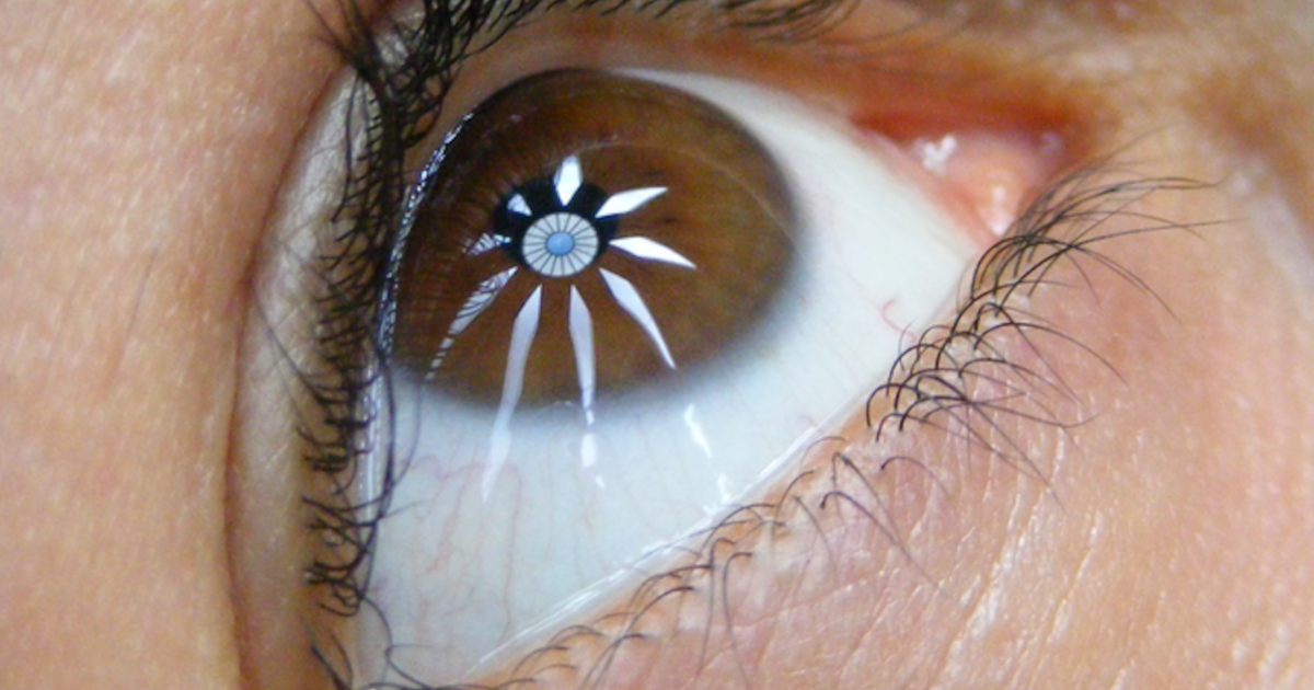 All About Eye Pressure: What’s Normal, Measurement, Glaucoma, and Treatment